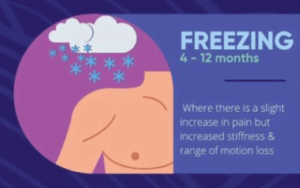 4 Stages of Frozen Shoulder | Pathogenesis, Clinical Features, Symptoms ...