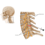 CERVICAL FACET JOINT SYNDROME - alleviatepainclinic